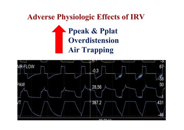 Cardio Pulmonary Interactions during Mechanical Ventilation | PDF