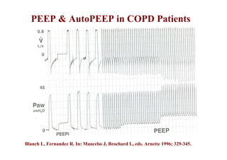 Cardio Pulmonary Interactions during Mechanical Ventilation | PDF