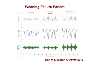 Cardio Pulmonary Interactions during Mechanical Ventilation | PDF