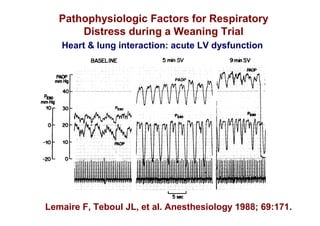 Cardio Pulmonary Interactions during Mechanical Ventilation | PDF