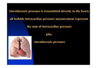 Cardio Pulmonary Interactions during Mechanical Ventilation | PDF