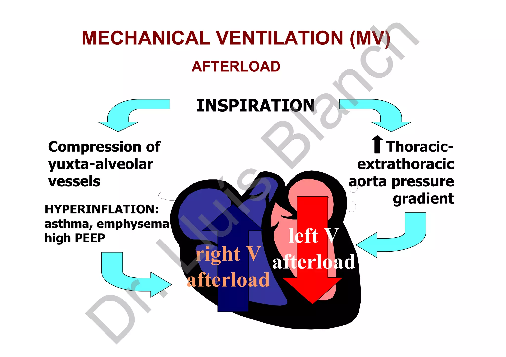 Cardio pulmonary interactions during Mechanical Ventilation | PDF