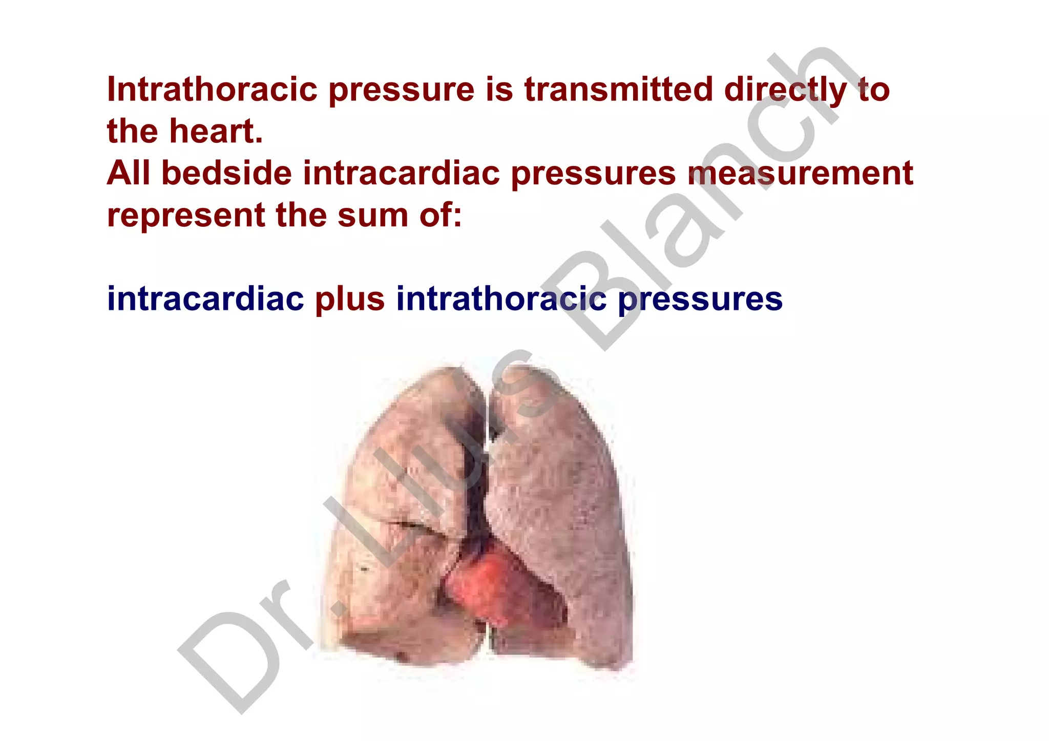Cardio pulmonary interactions during Mechanical Ventilation | PDF