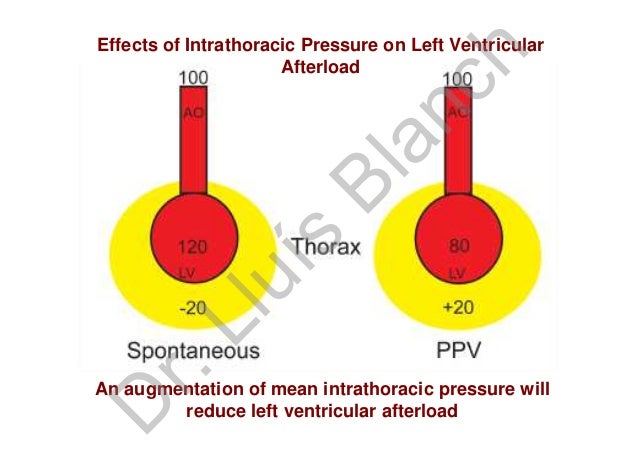 Cardio pulmonary interactions during Mechanical Ventilation