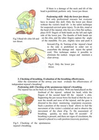 CARDIO PULMONARY REANIMATION.pdf