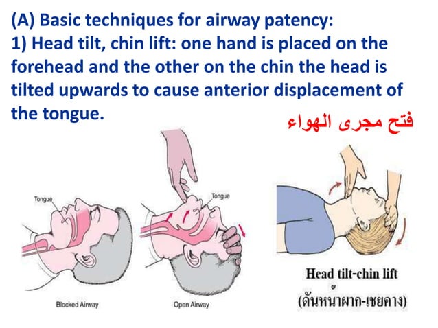 Samir Rafla-CARDIOPULMONARY Resuscitation | PPT