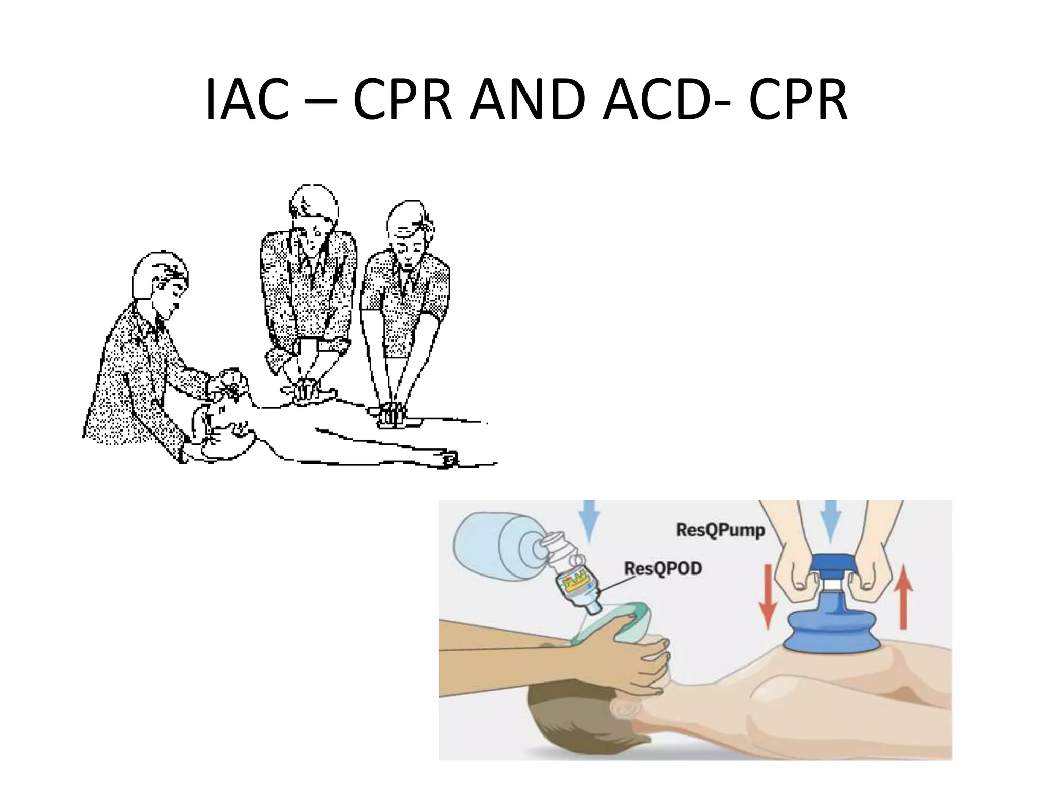 Cardiopulmonary resuscitation | PPTX