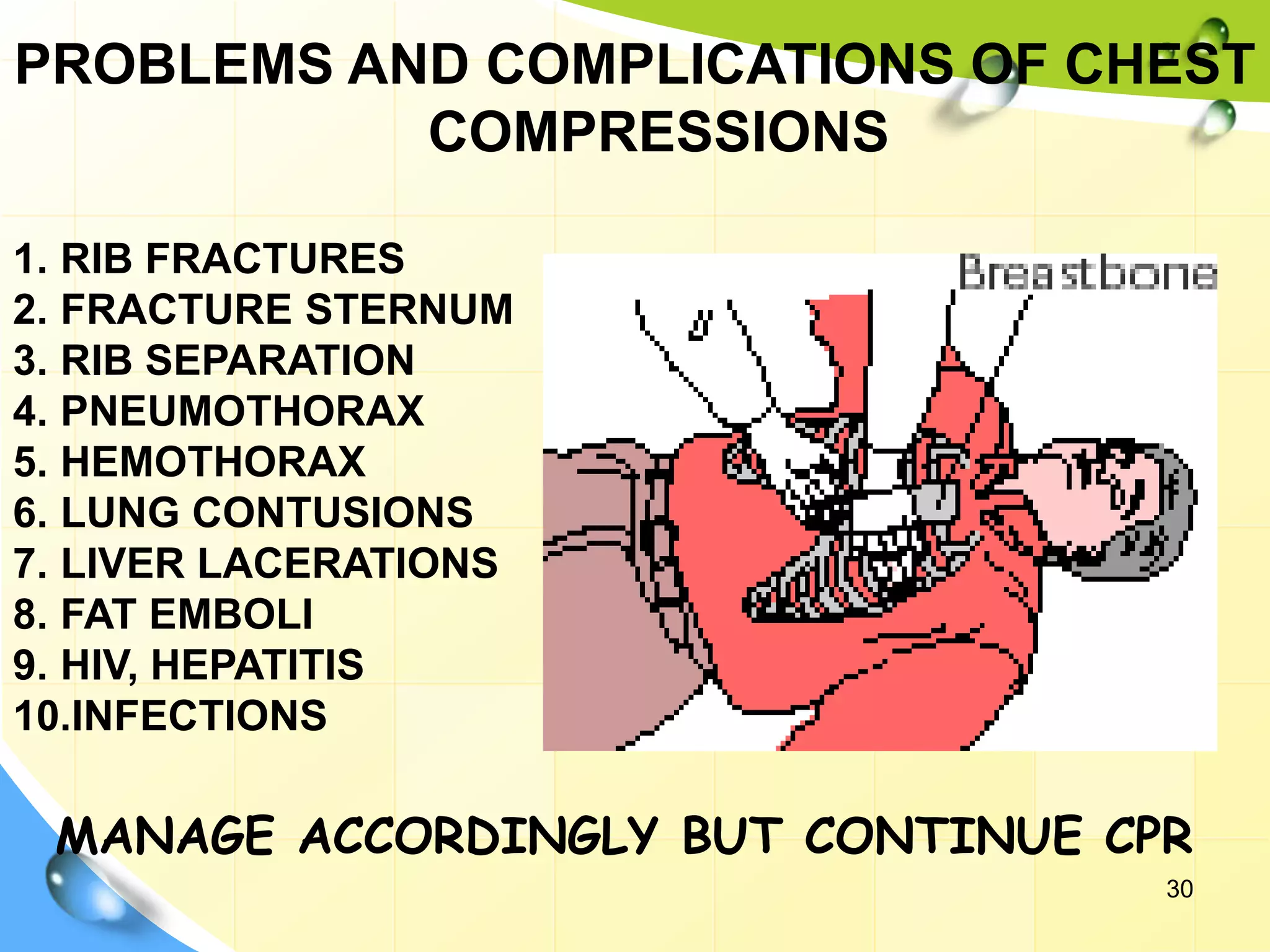 Cardiopulmonary resuscitation | PPTX