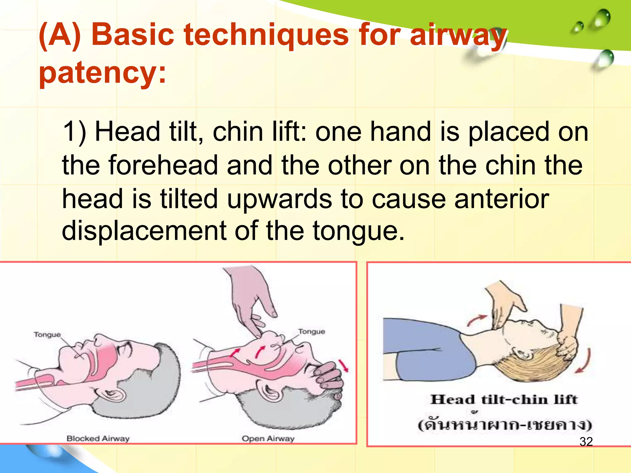 Cardiopulmonary resuscitation | PPTX