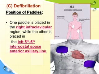 Cardiopulmonary resuscitation | PPTX
