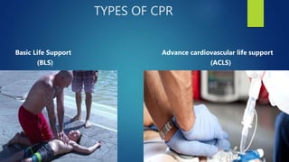 Cardiopulmonary resuscitation | PPTX | First Aid | Injuries