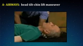 Cardiopulmonary resuscitation (CPR) | PPSX