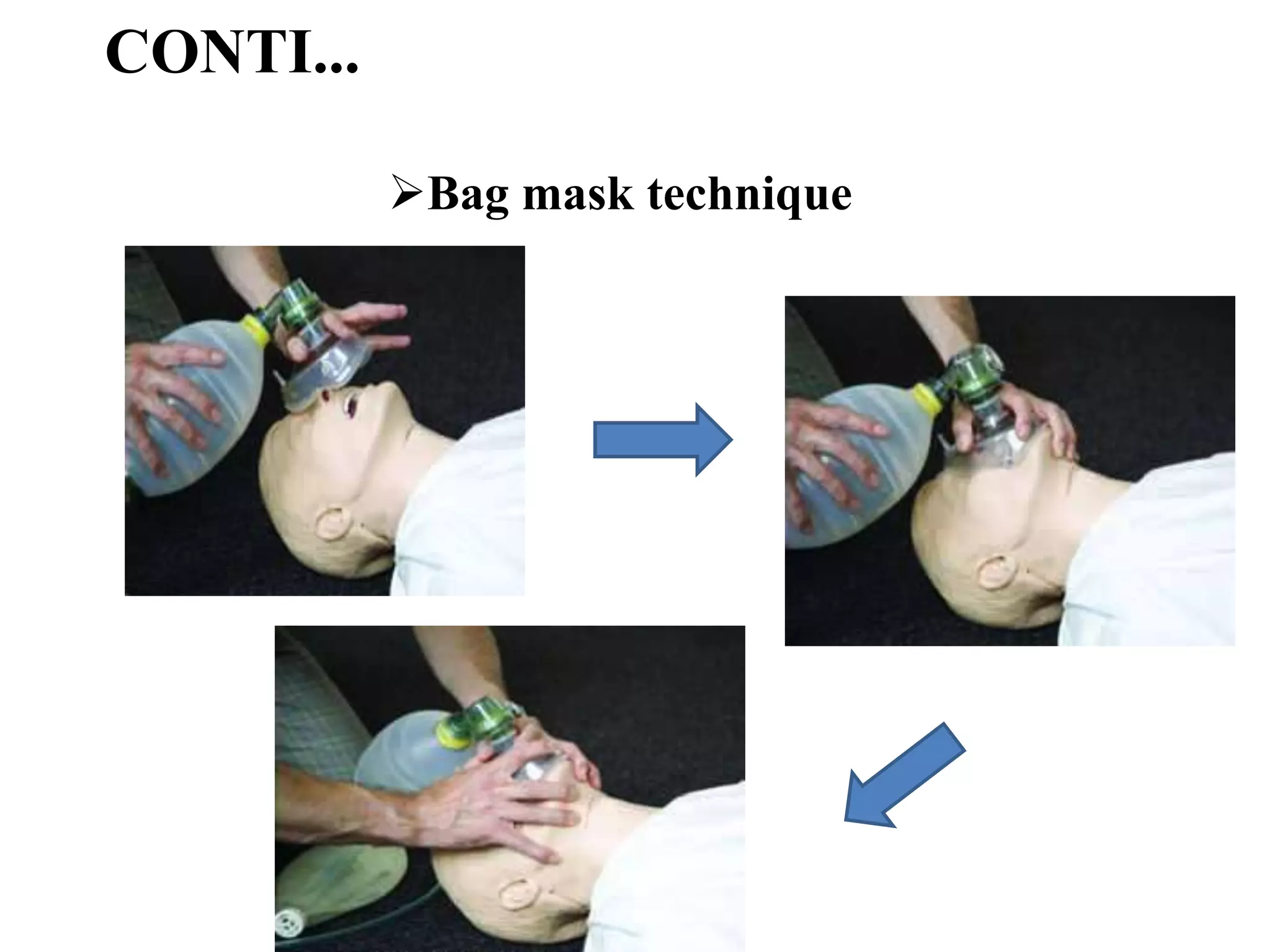 Cardiopulmonary resuscitation (CPR) | PPTX