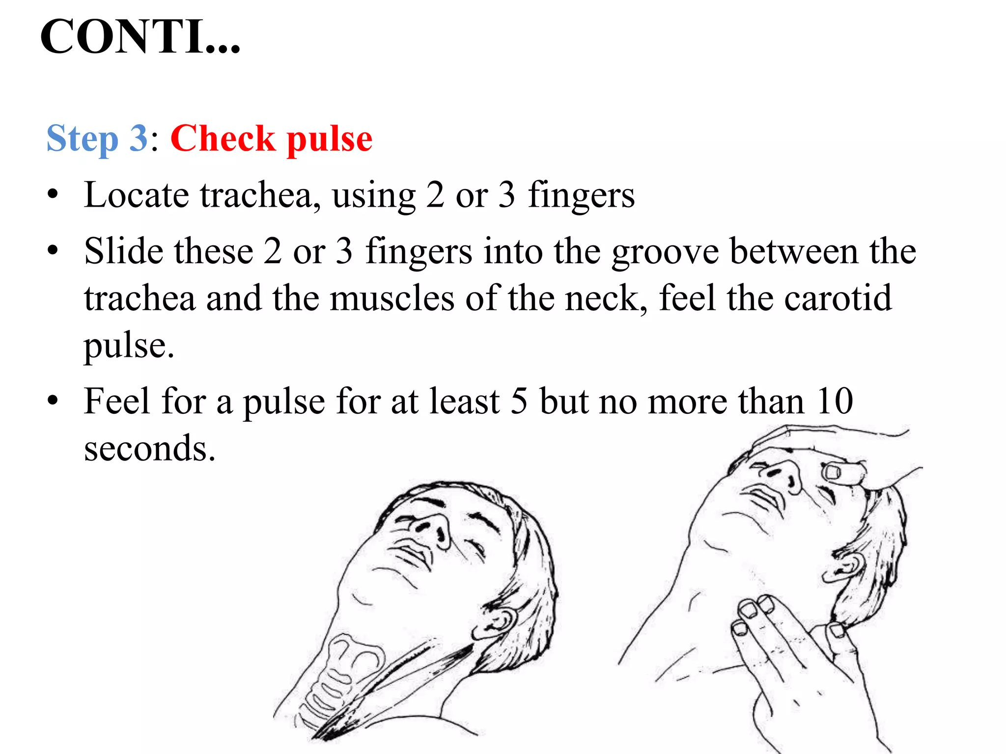 Cardiopulmonary resuscitation (CPR) | PPTX