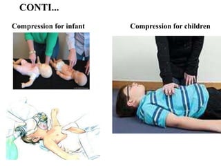 Cardiopulmonary resuscitation (CPR) | PPTX