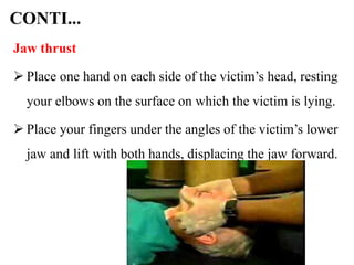 Cardiopulmonary resuscitation (CPR) | PPTX