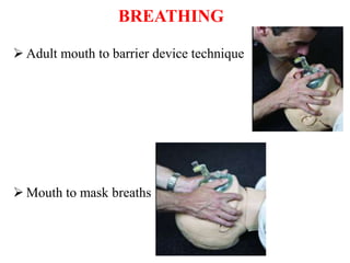 Cardiopulmonary resuscitation (CPR) | PPTX