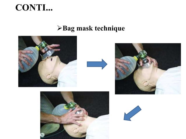 Cardiopulmonary resuscitation (CPR) | PPTX