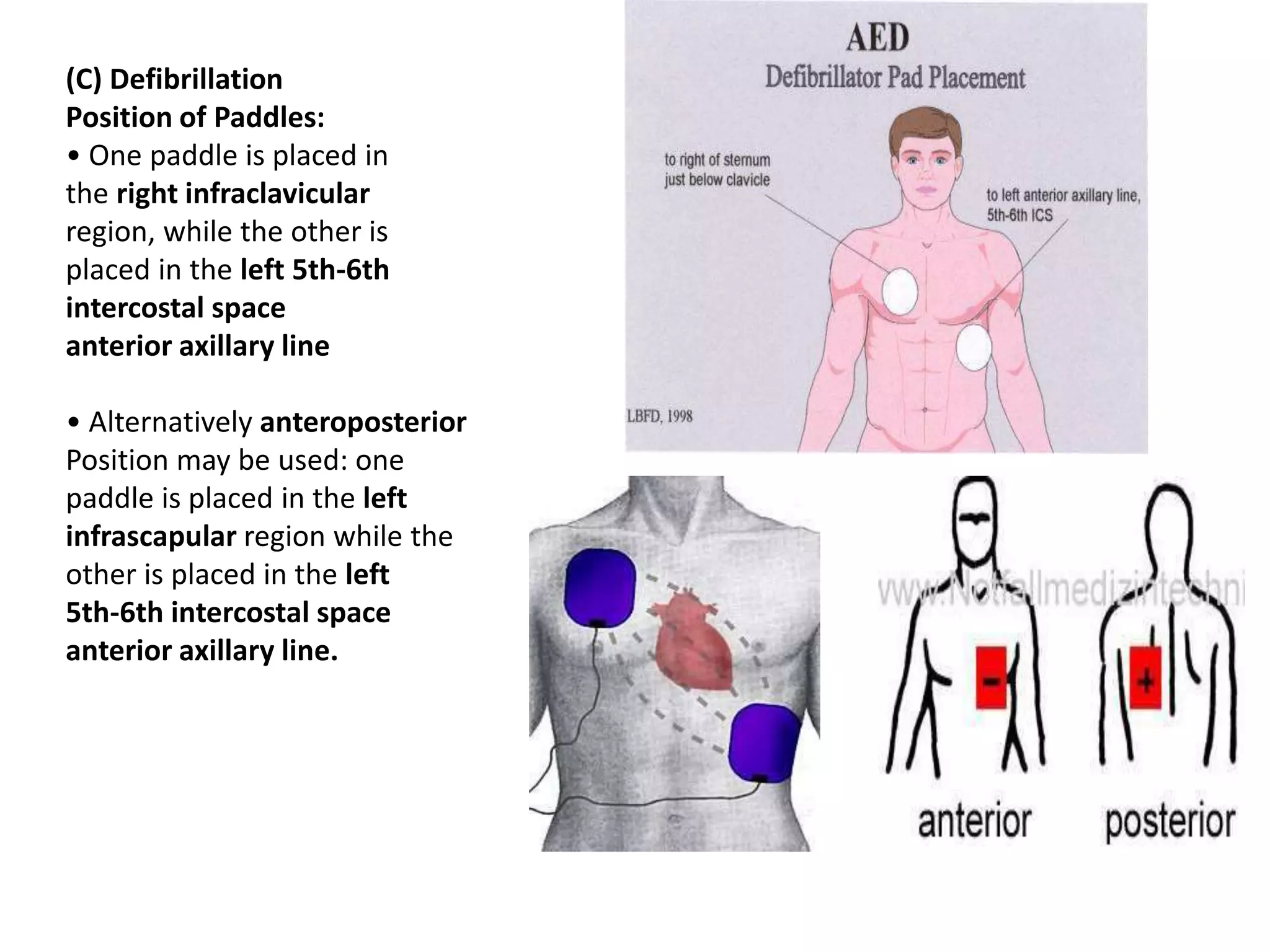 Cardiopulmonary resuscitation | PPTX