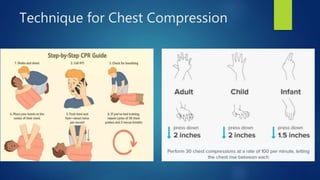 Cardiopulmonary resuscitation | PPT