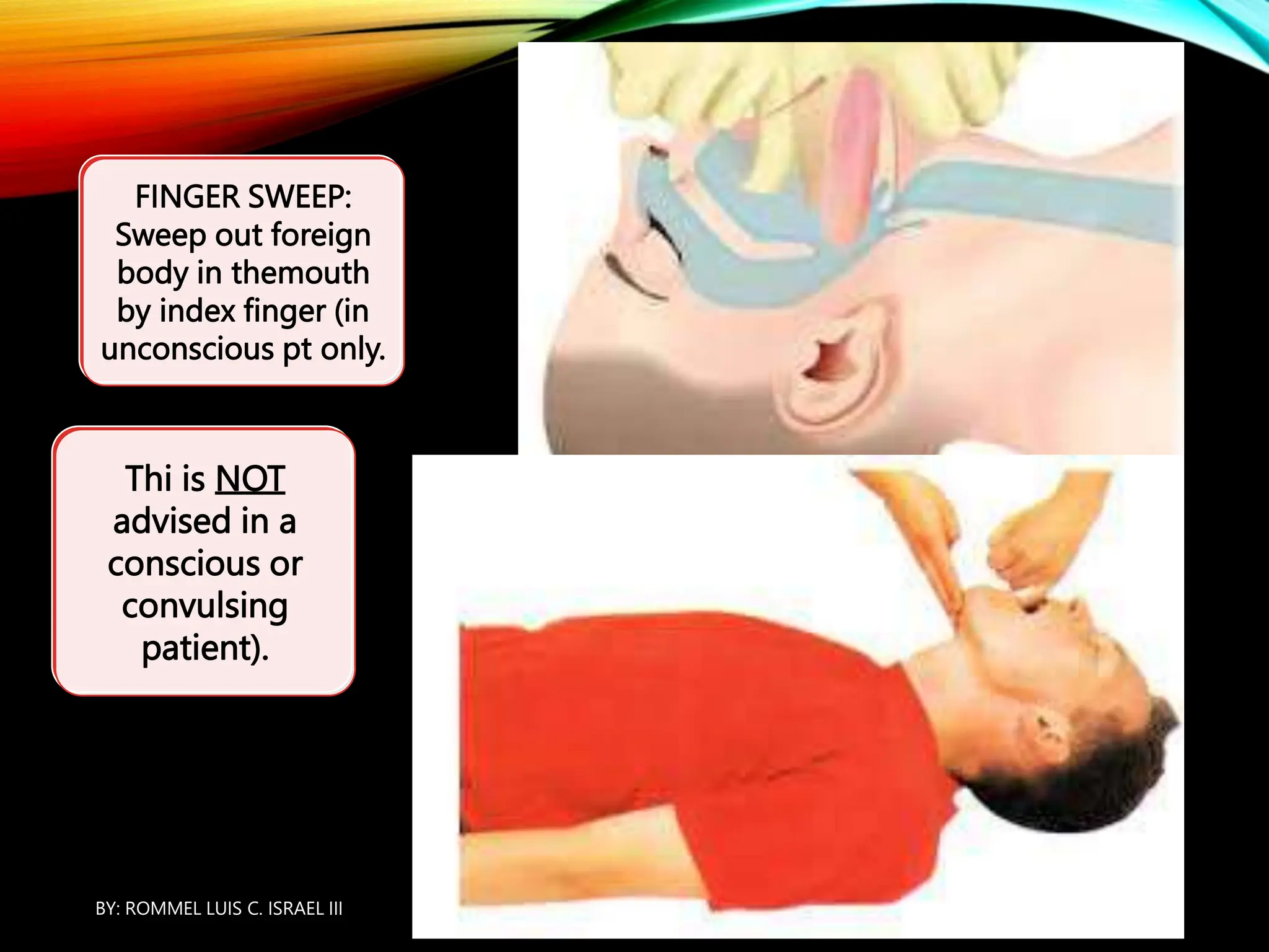 CARDIOPULMONARY RESUSCITATION - BLS & ALS TECHNIQUES | PPT