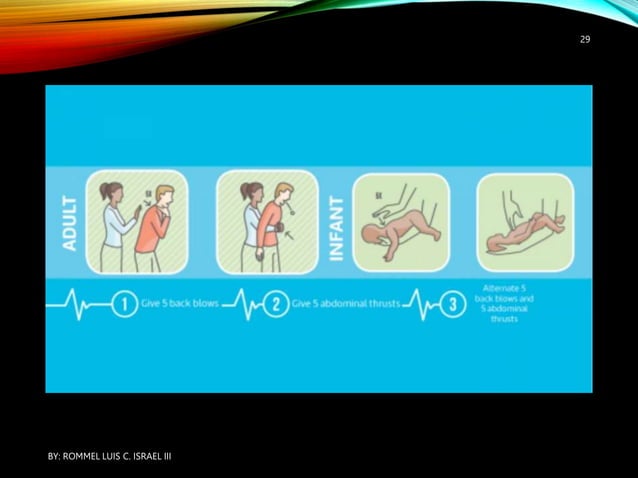 CARDIOPULMONARY RESUSCITATION - BLS & ALS TECHNIQUES | PPT