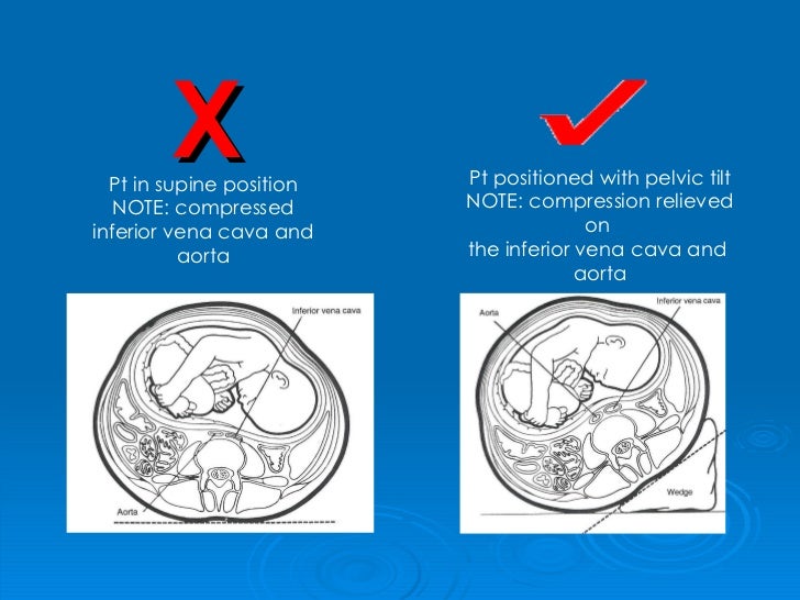 Cardio pulmonary resuscitation 2011