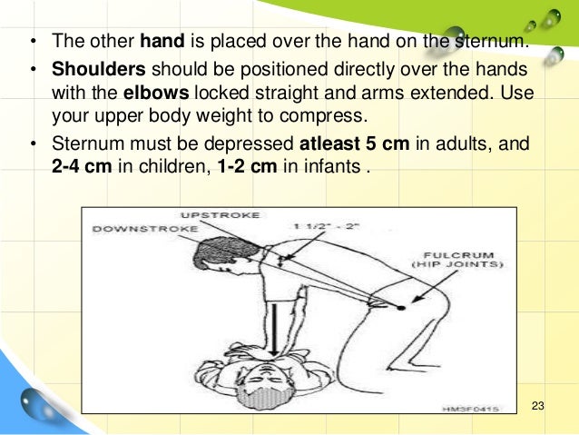 Cardiopulmonary resuscitation (cpr)