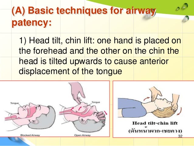 Cardiopulmonary resuscitation (cpr)