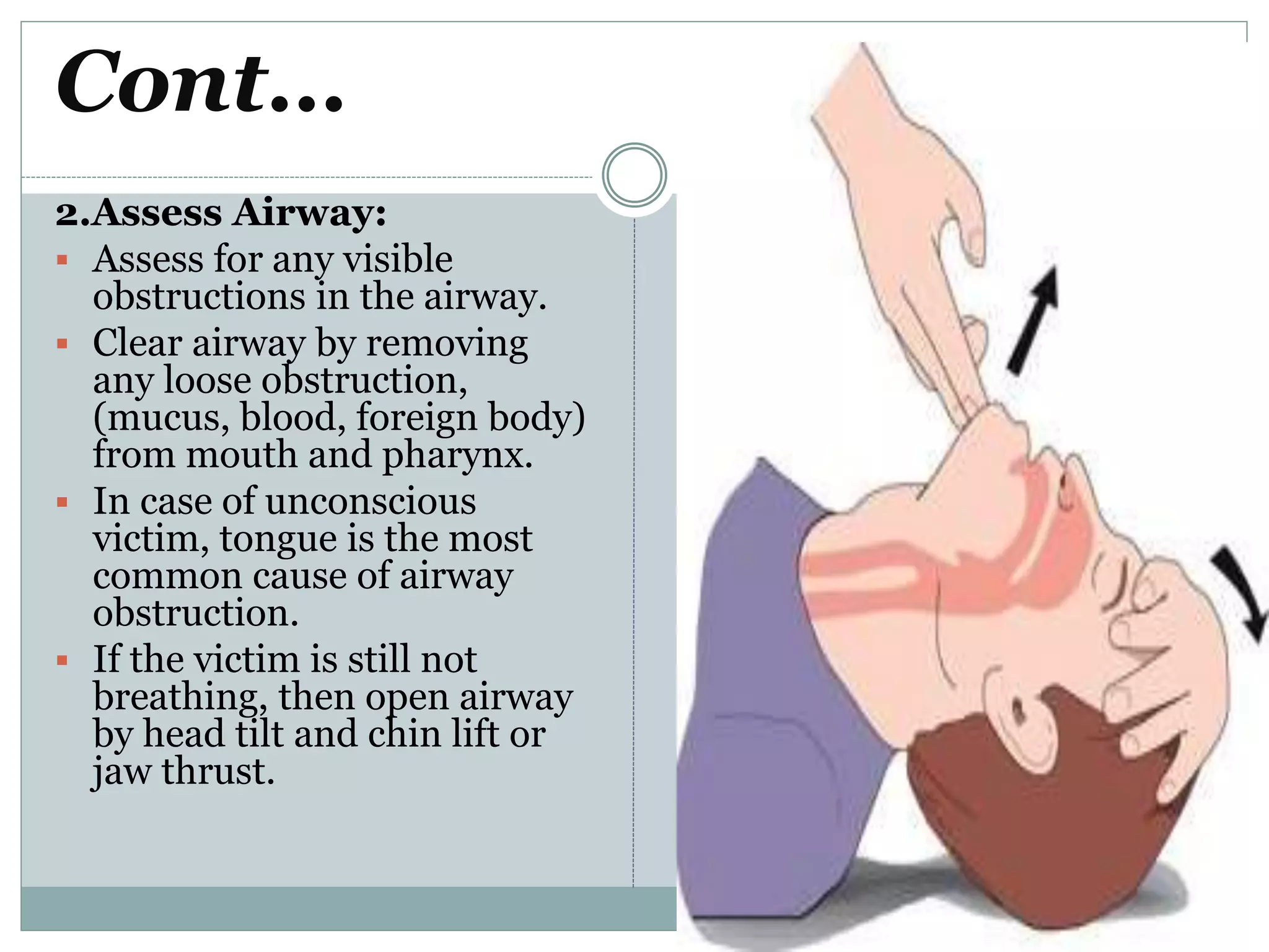 Cardiopulmonary resuscitation(cpr) | PPTX