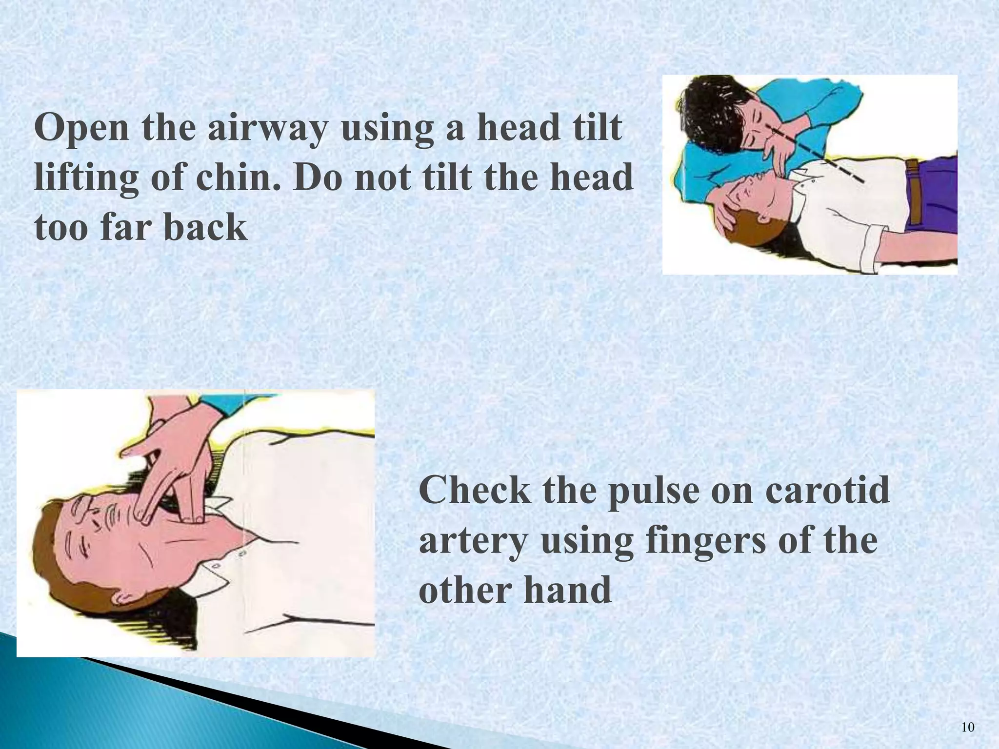 Cardiopulmonary resuscitation [cpr] | PPT
