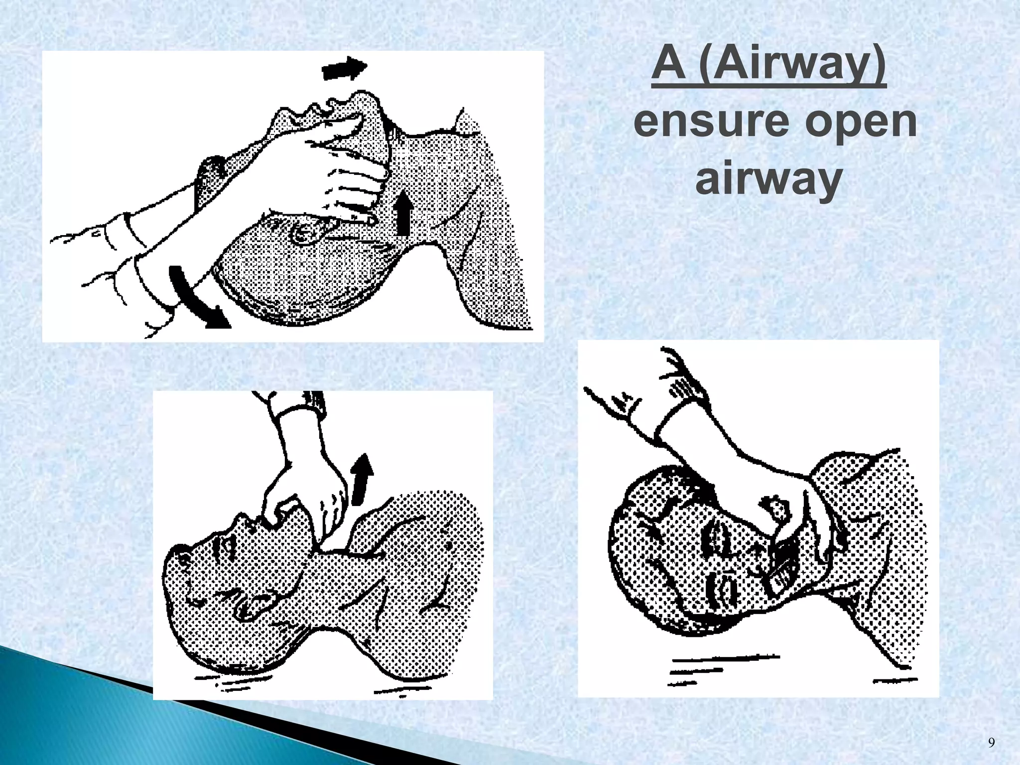 Cardiopulmonary resuscitation [cpr] | PPT
