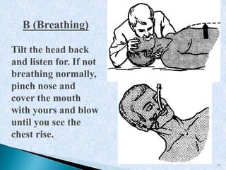 Cardiopulmonary resuscitation [cpr] | PPT