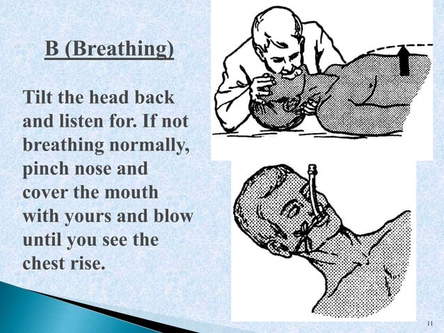 Cardiopulmonary resuscitation [cpr] | PPT