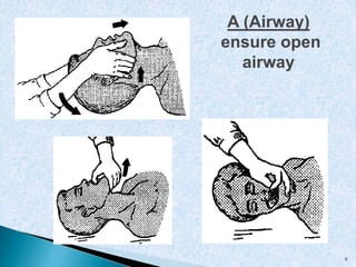 Cardiopulmonary resuscitation [cpr] | PPT
