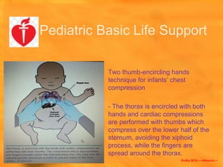 Basic Life support | PPT