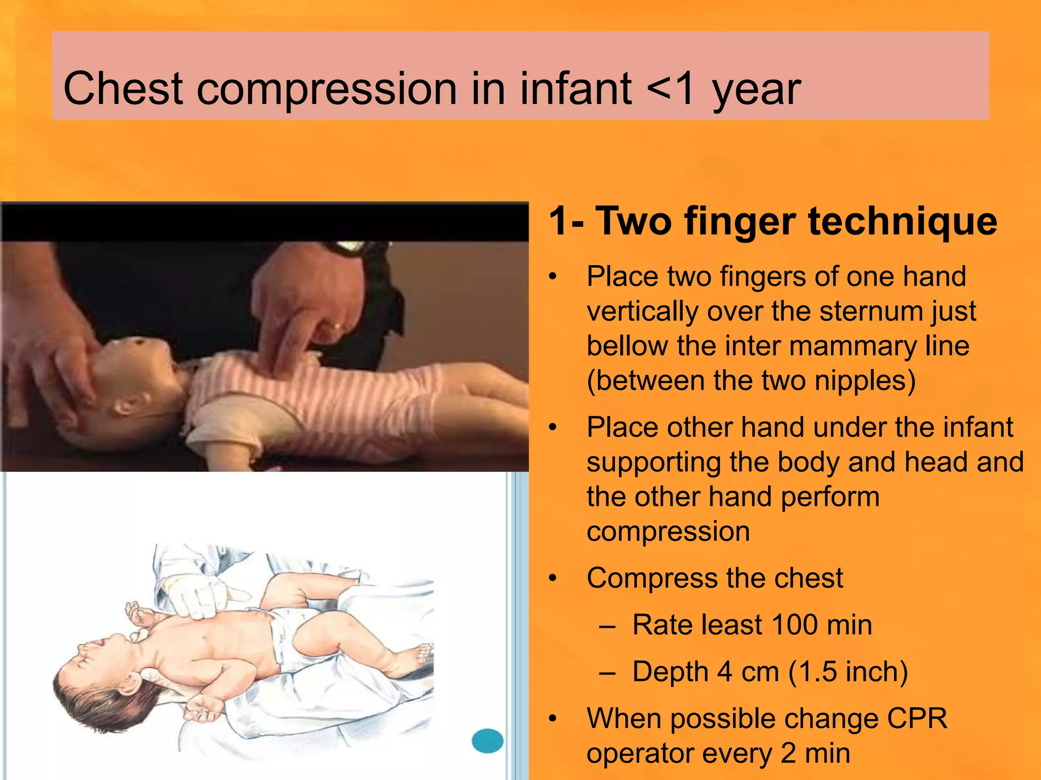 Cardiopulmonaryresuscitationppt 130317014608-phpapp02 | PDF