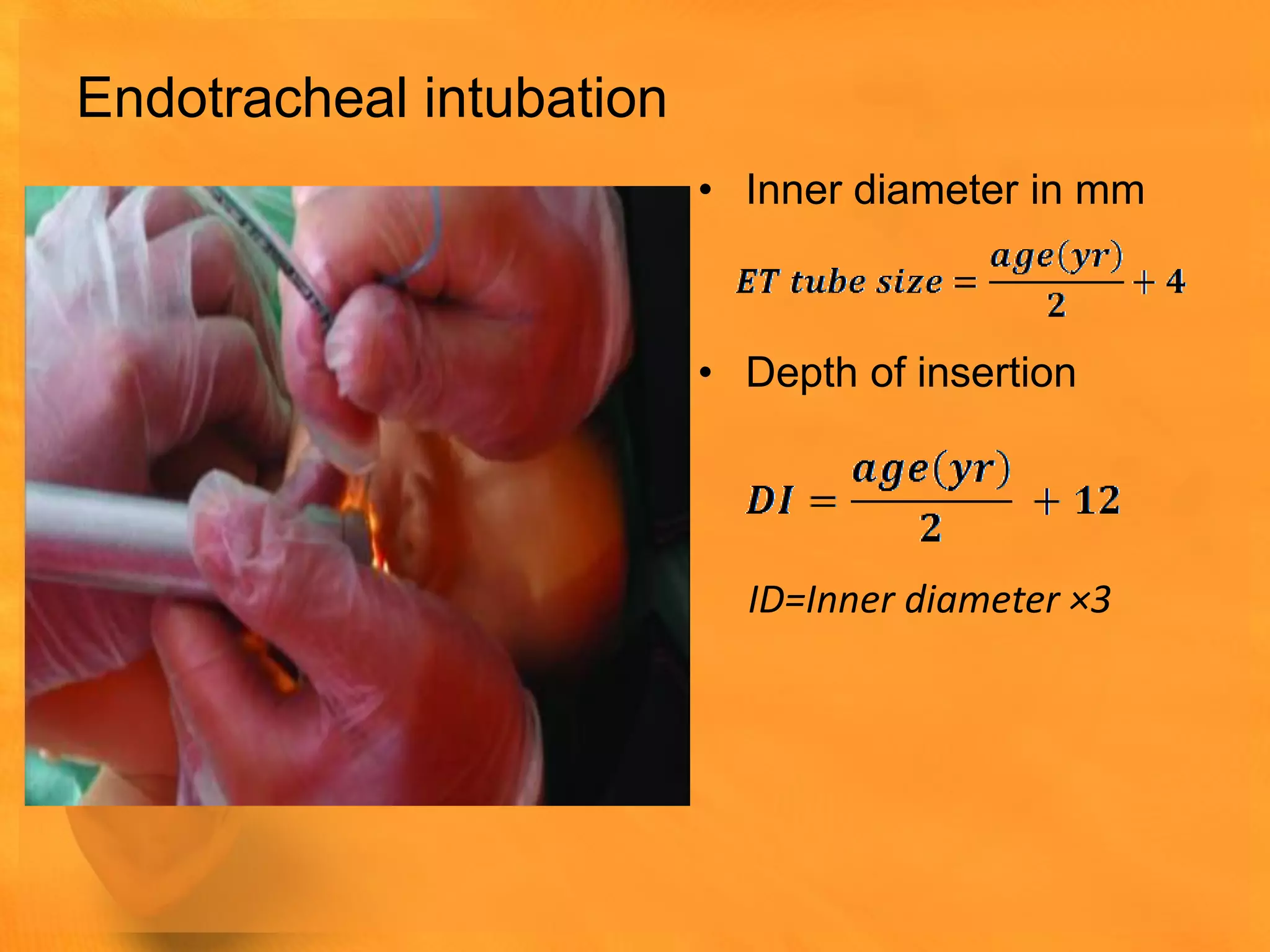 Cardiopulmonaryresuscitationppt 130317014608-phpapp02 | PDF