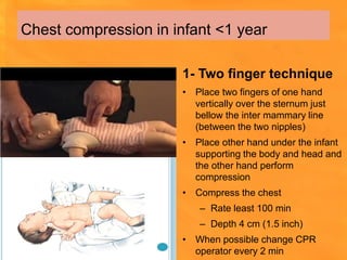 Cardiopulmonaryresuscitationppt 130317014608-phpapp02 | PDF