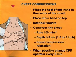 Cardio pulmonary resuscitationppt | PPT