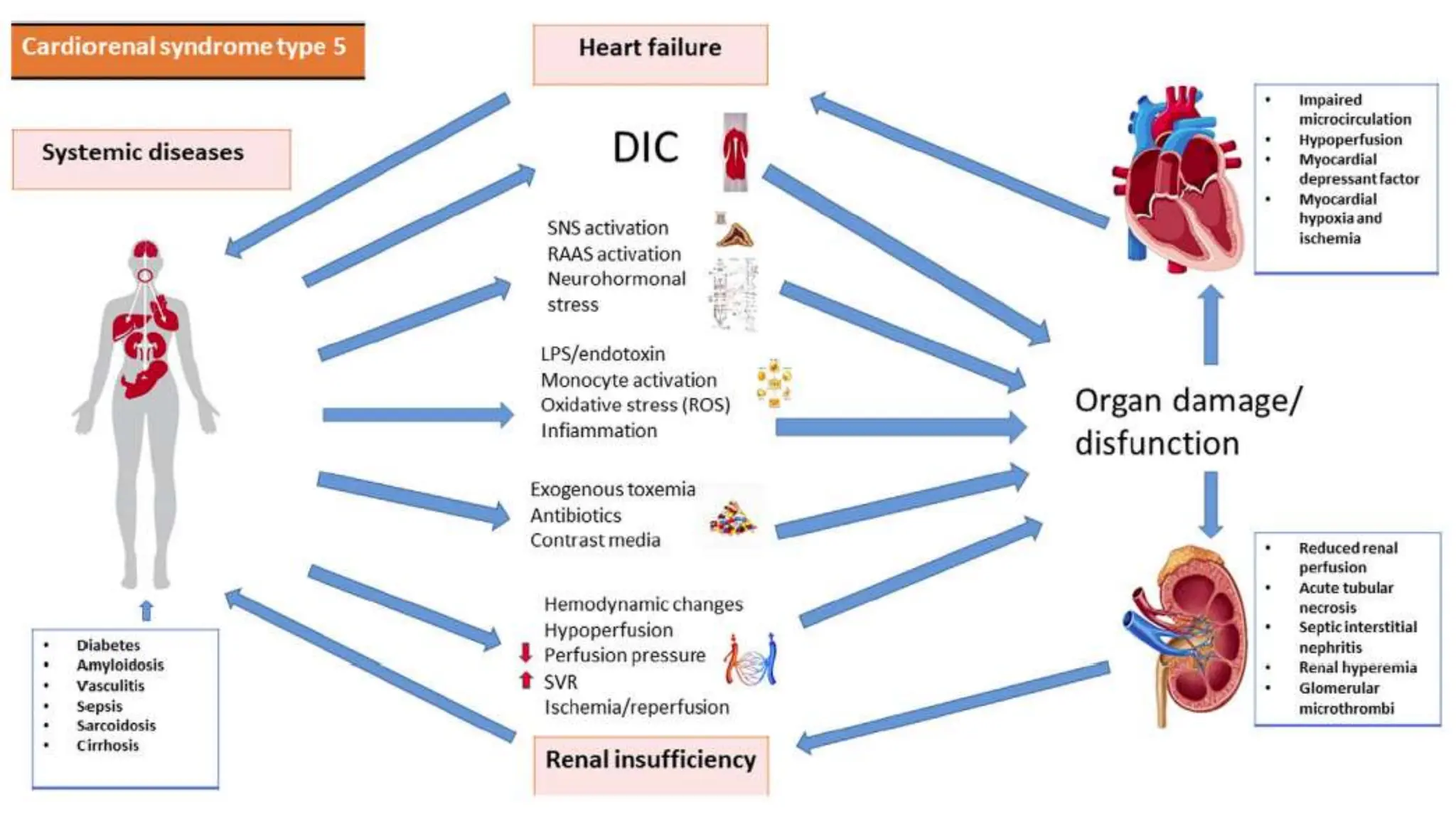 Cardio Renal Syndrome CRS All types.pptx