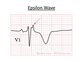 Cardiovascular System Images | PPT