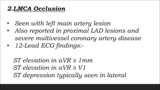 STEMI EQUIVALENT.pdf