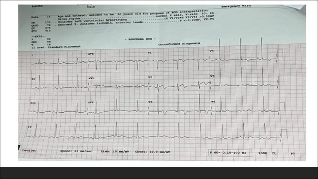 STEMI EQUIVALENT.pdf
