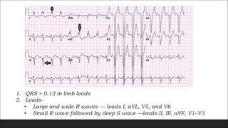 STEMI EQUIVALENT.pdf