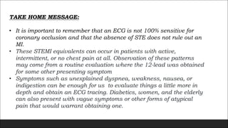 STEMI EQUIVALENT.pdf