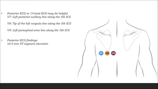 STEMI EQUIVALENT.pdf