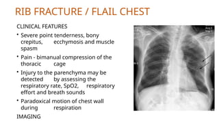 CARDIOTHORACIC TRAUMA pptx for students of final year mbbs | PPTX