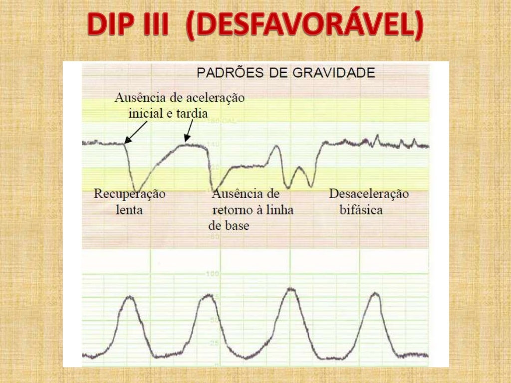 Cardiotocografia