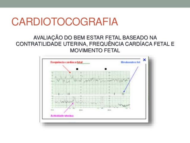 Cardiotocografia